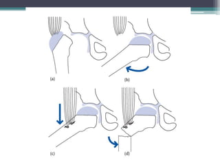 Septic arthritis sequelae. | PPTX