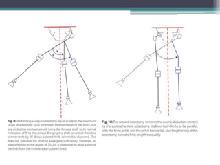 Septic arthritis sequelae. | PPTX