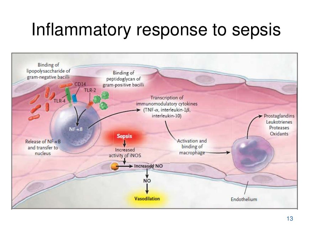 Septicemia