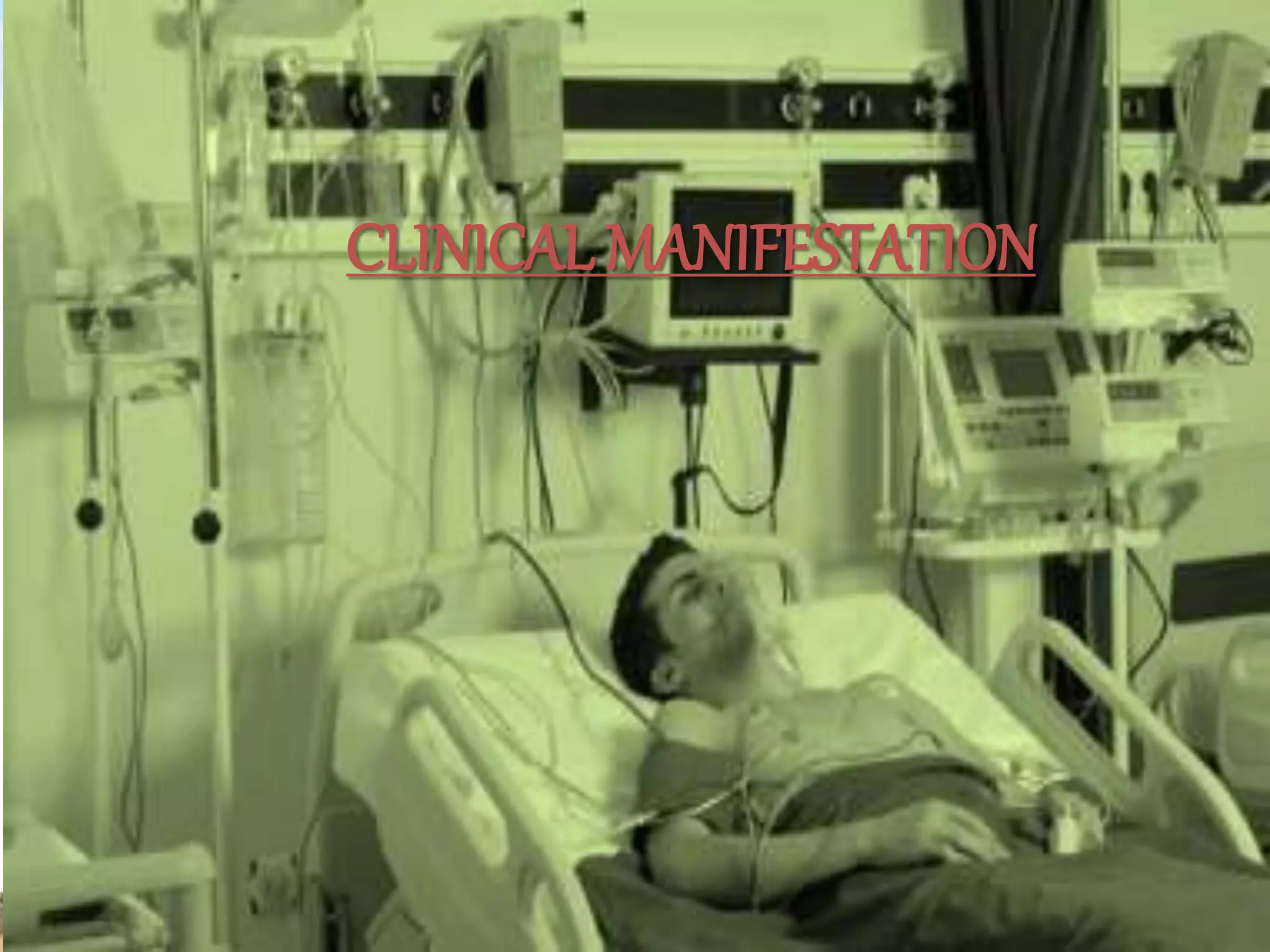Septicemia | PPTX