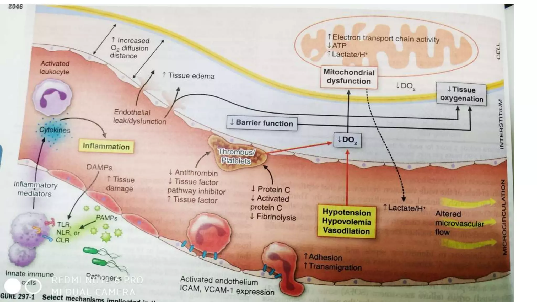 Septicemia | PPTX