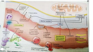 Septicemia | PPTX