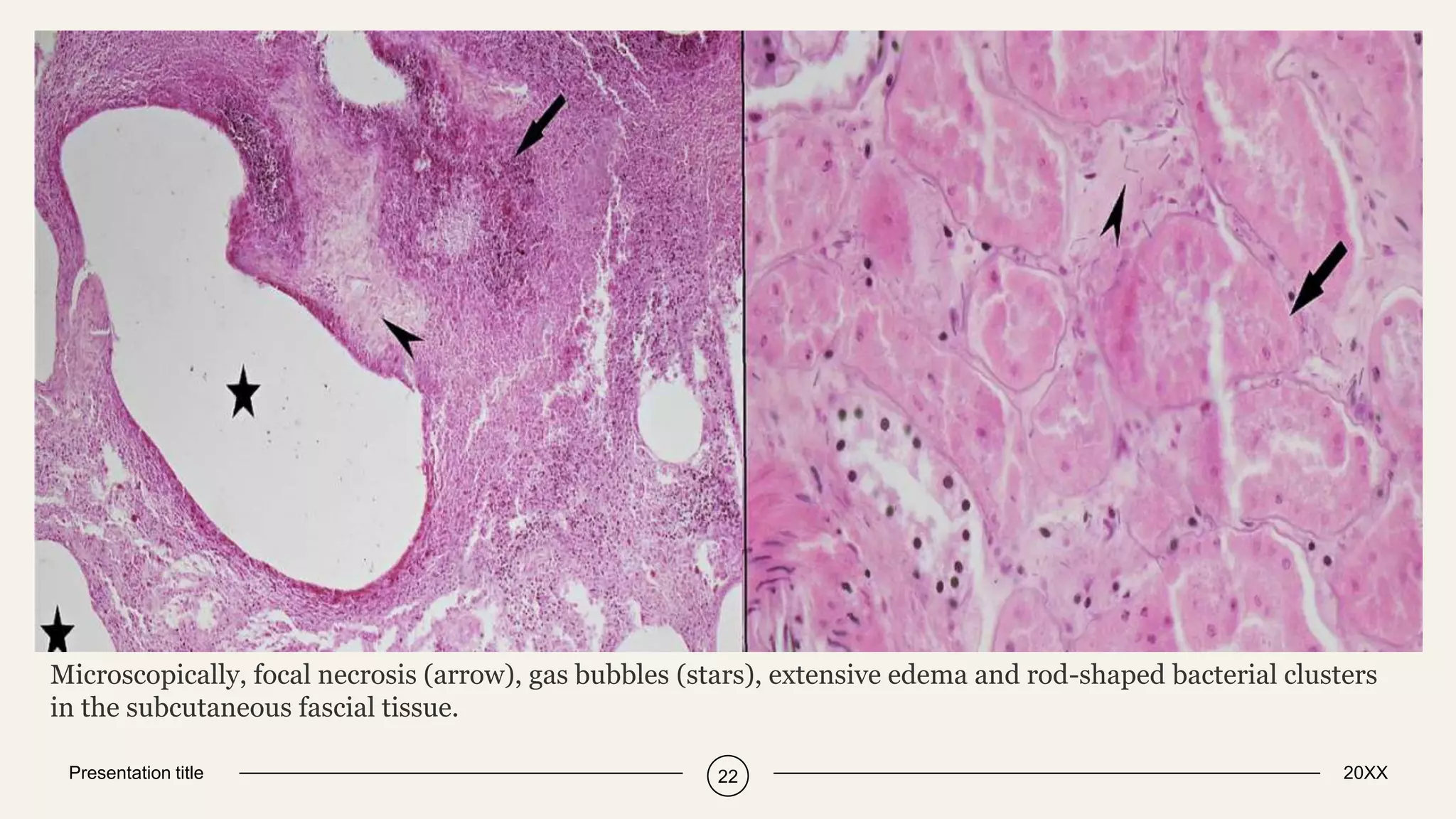 Septicemia and toxemia.pptx