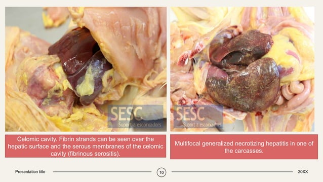 Septicemia and toxemia.pptx