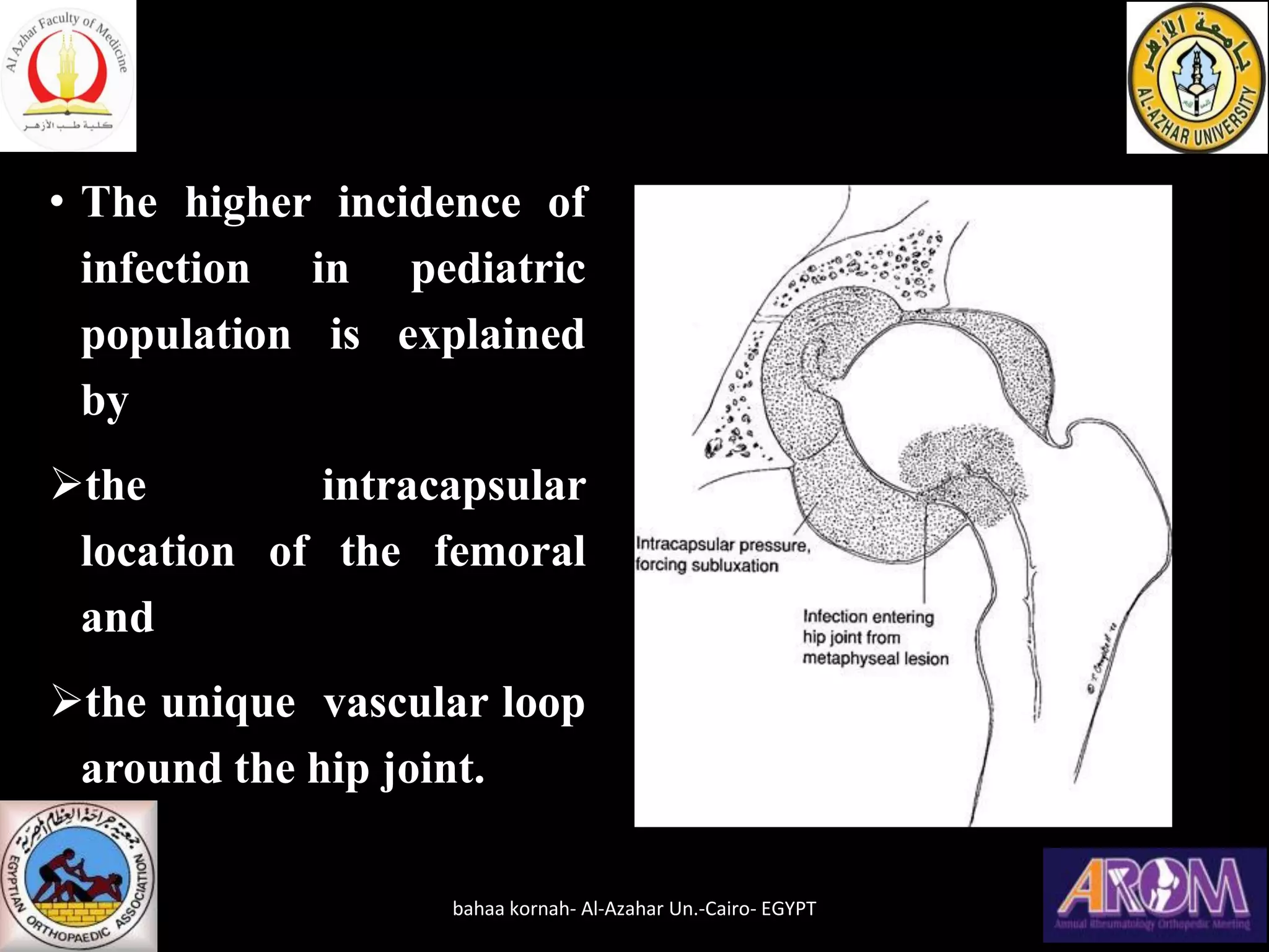 Septic epiphysitis in neonates and infants | PPT