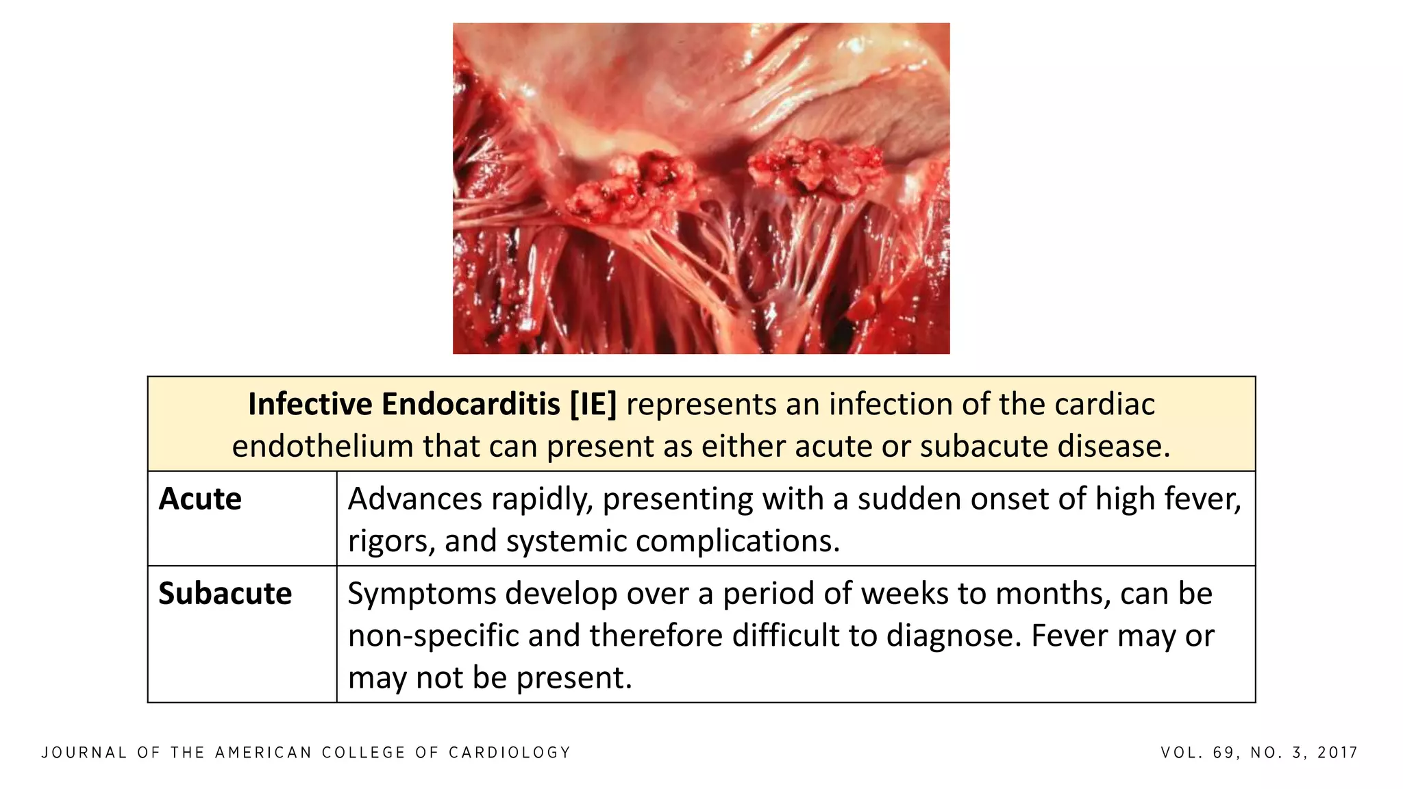 EMGuideWire's Radiology Reading Room: Septic Pulmonary Emboli | PPTX