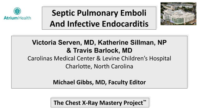 EMGuideWire's Radiology Reading Room: Septic Pulmonary Emboli | PPTX