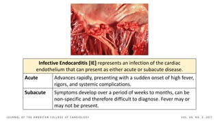 EMGuideWire's Radiology Reading Room: Septic Pulmonary Emboli | PPTX