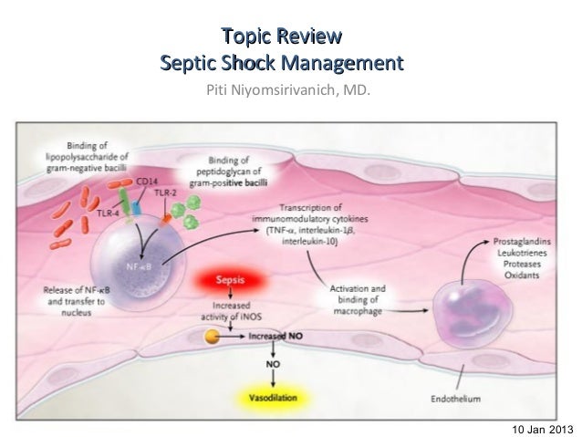 Septic shock