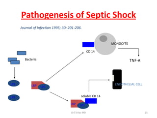 Sepsis Pathophysiology Diagram