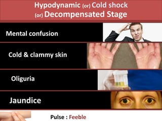 Septic shock | PPTX