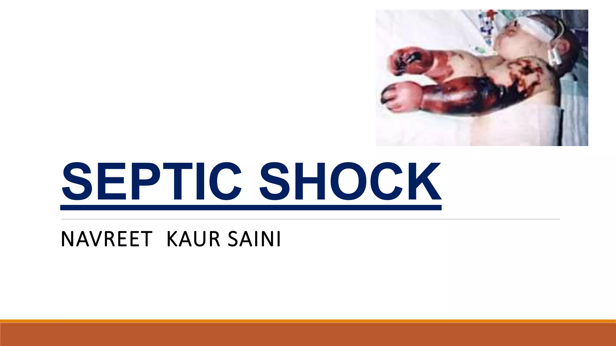 Septic shock | PPTX