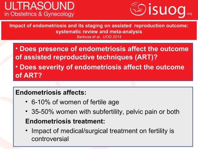 UOG Journal Club: Impact of endometriosis and its staging on assisted ...