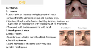 septum and its diseasese detail presentation .pptx