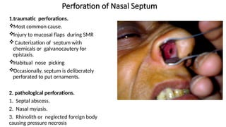 septum and its diseasese detail presentation .pptx
