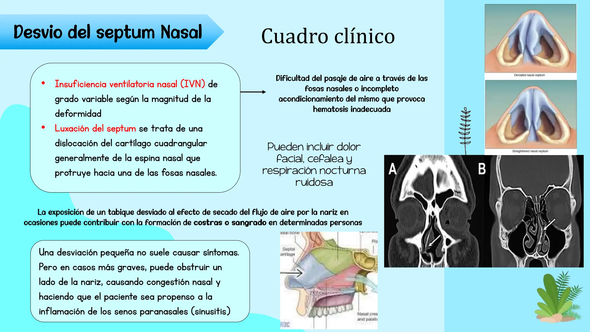 SEPTUM NASAL otorrinolaringologia desvio del septum nasal | PPT