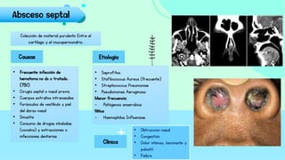 SEPTUM NASAL otorrinolaringologia desvio del septum nasal | PPTX