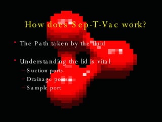 Sep T Vac Suctionsystem | PPT