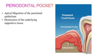 Sequelae of periodontal diseases | PPT