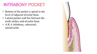 Sequelae of periodontal diseases | PPT