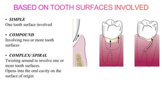 Sequelae of periodontal diseases | PPT