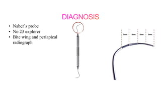 Sequelae of periodontal diseases | PPT