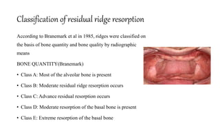 SEQUELAE OF WEARING COMPLETE DENTURE.pptx