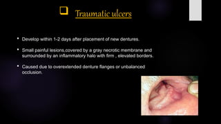 sequelae of wearing complete denture.pptx