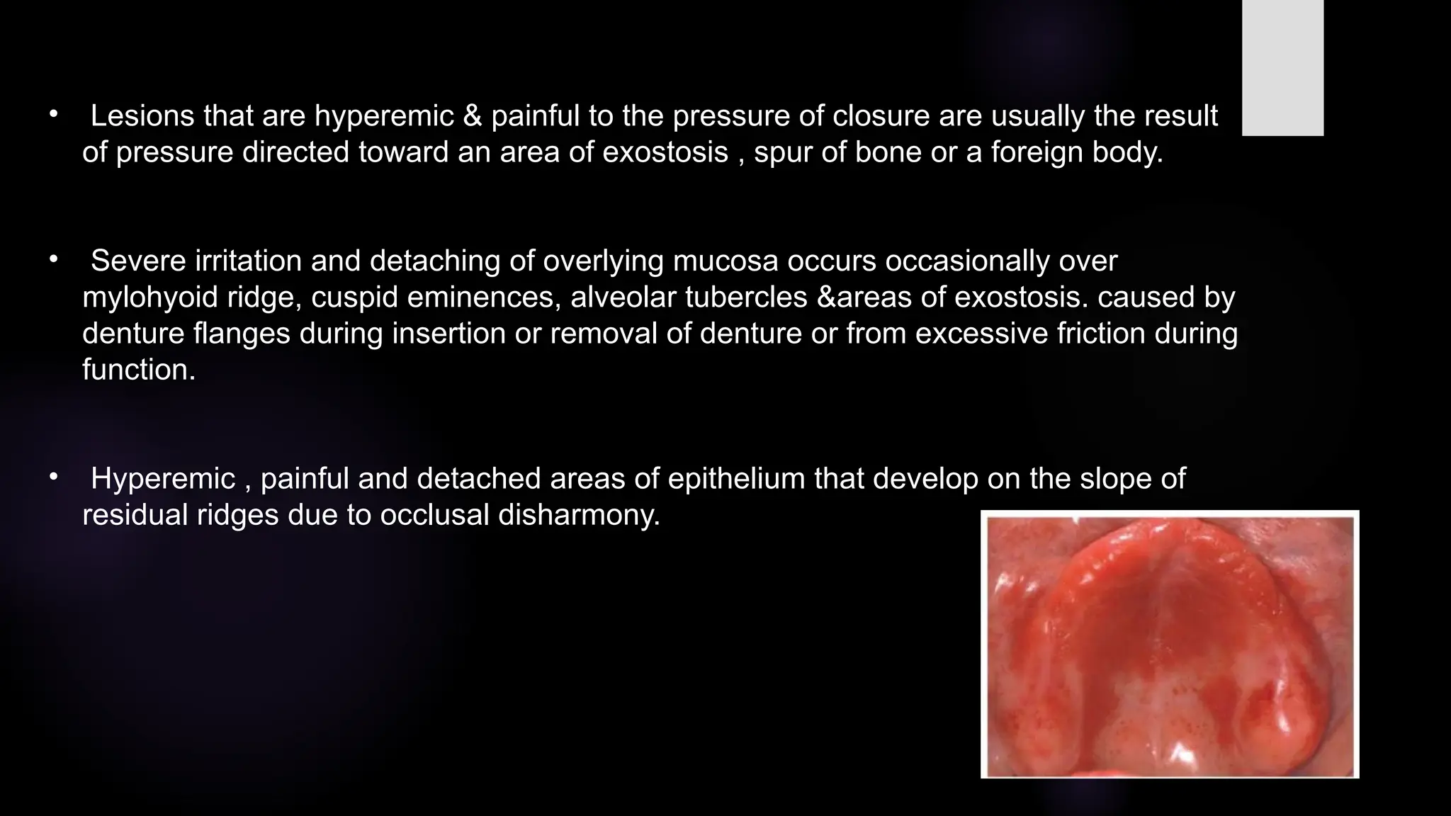 sequelae of wearing complete denture.pptx
