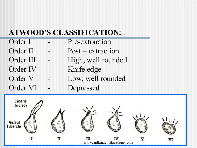 Sequelae of wearing complete dentures/ orthodontics training courses
