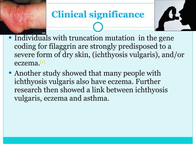 Sequence Alignment In Bioinformatics | PPT | Skin and Dermatology | Diseases and Conditions