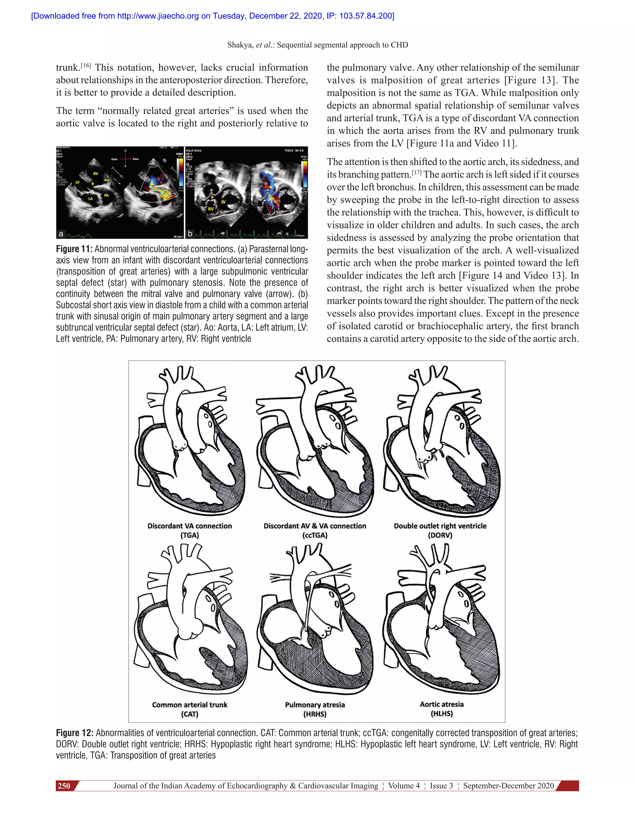 Sequencial segmental approach to chd | PDF