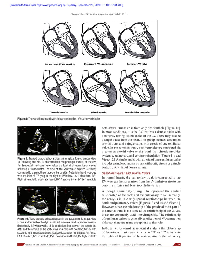 Sequencial segmental approach to chd | PDF