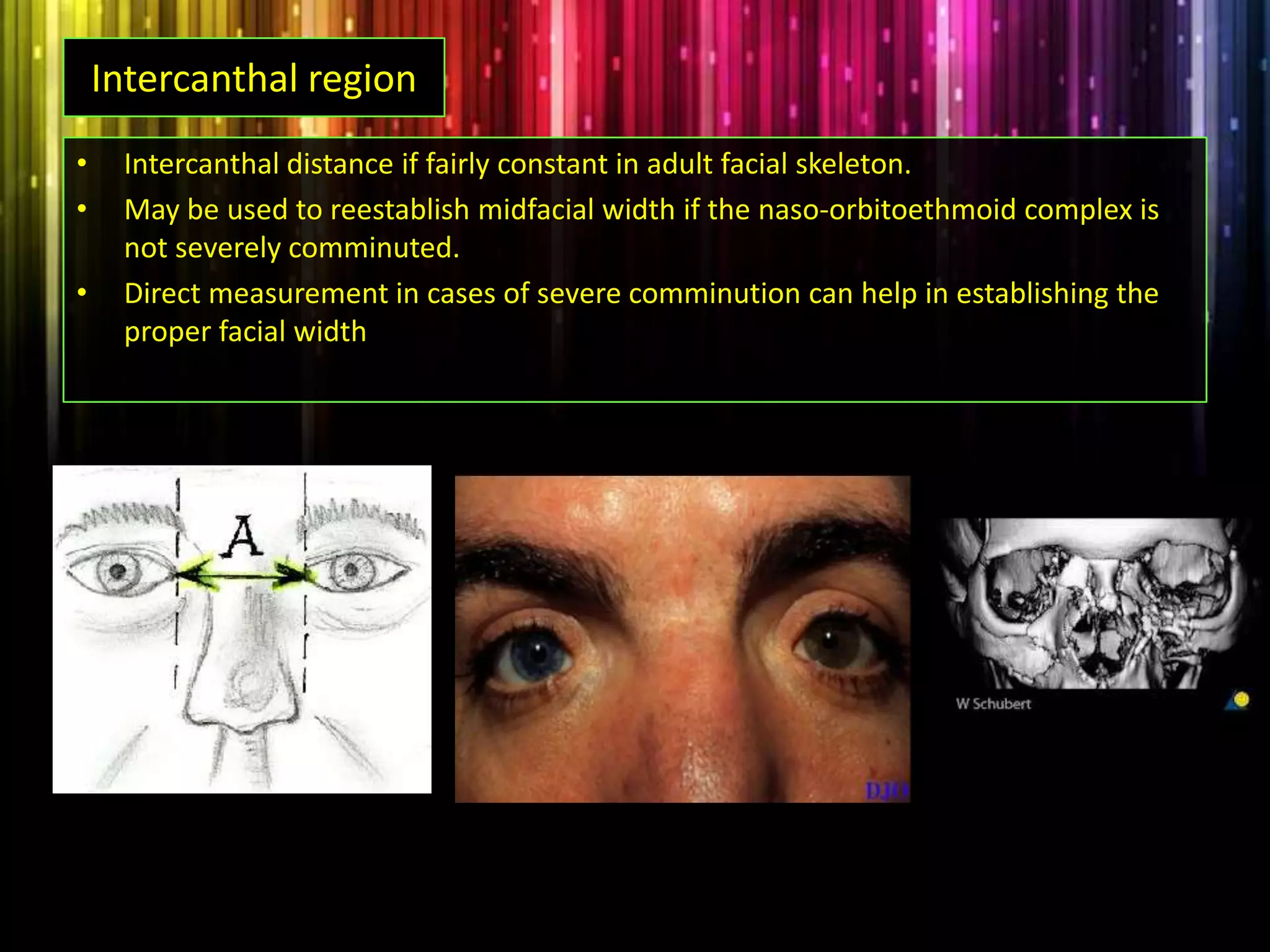 Sequencing in panfacial trauma | PPTX