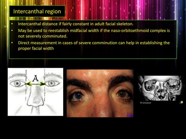 Sequencing in panfacial trauma | PPTX