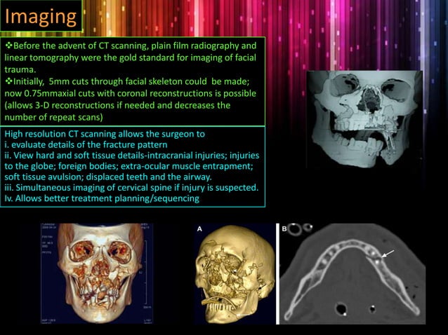 Sequencing in panfacial trauma | PPTX