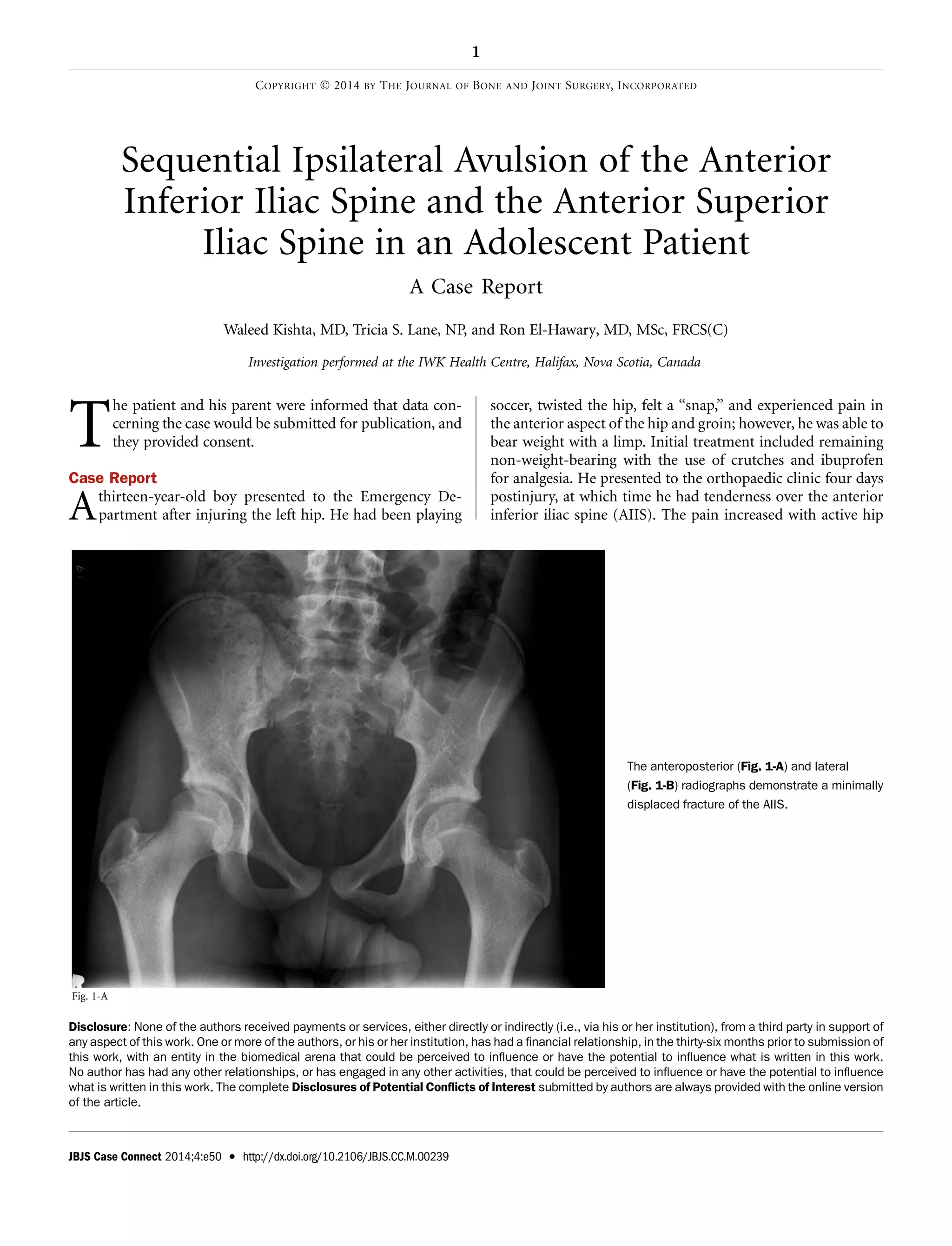 Sequential Ipsilateral Avulsion of the Anterior Inferior Iliac Spine ...