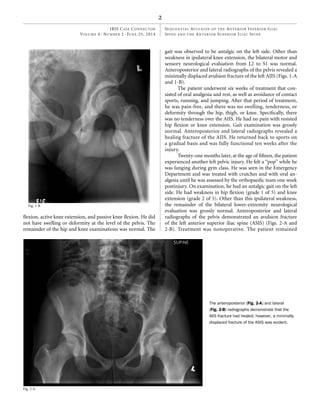 Sequential Ipsilateral Avulsion of the Anterior Inferior Iliac Spine ...