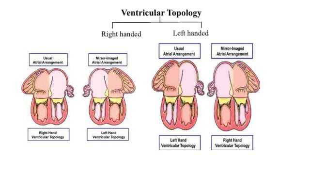 Sequential segmental analysis | PPTX | Heart and Cardiovascular ...