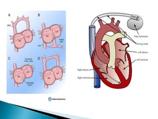 Sequential segmental analysis elkhatib | PPTX