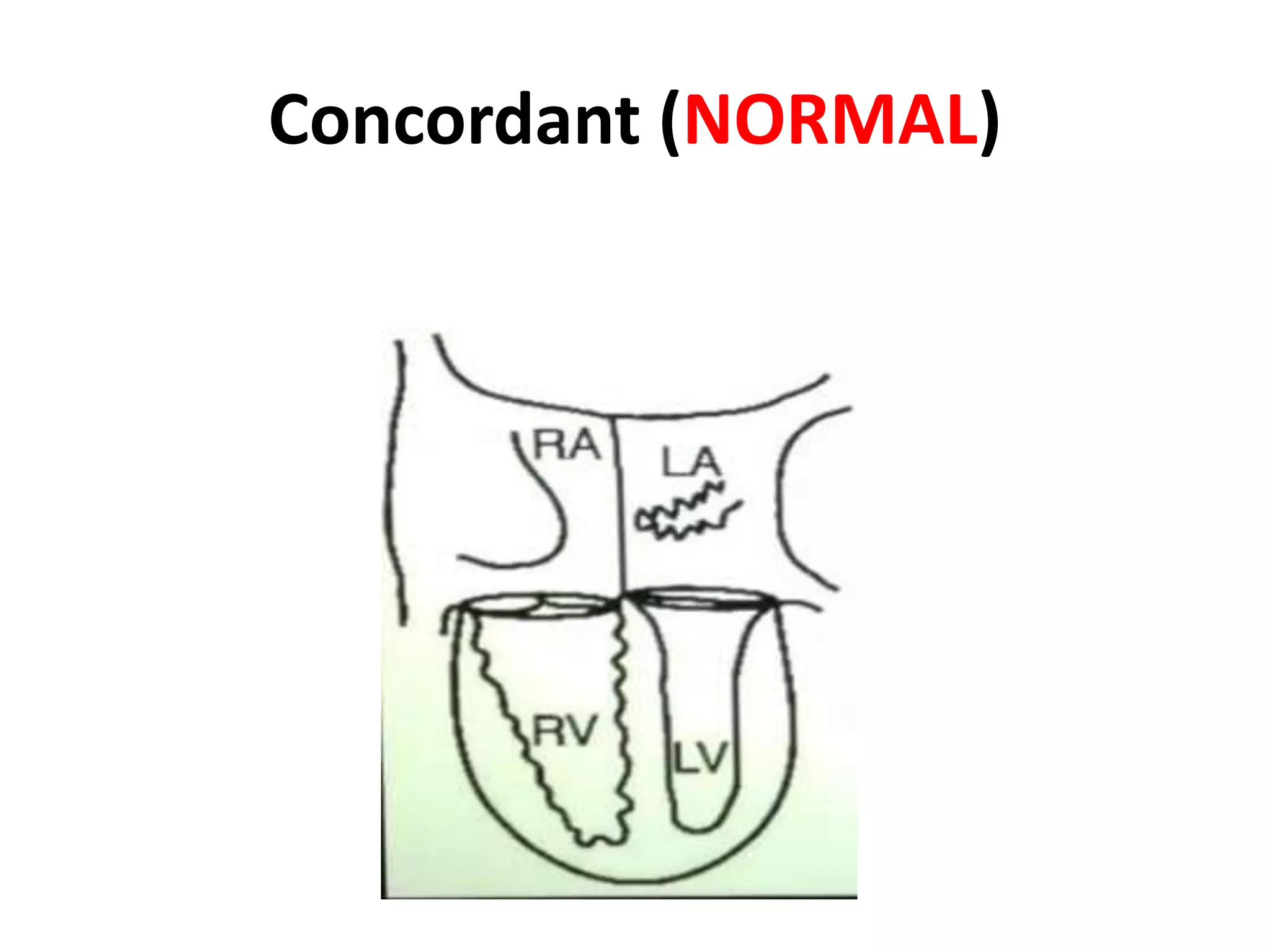 Sequential segmental analysis of heart | PPTX