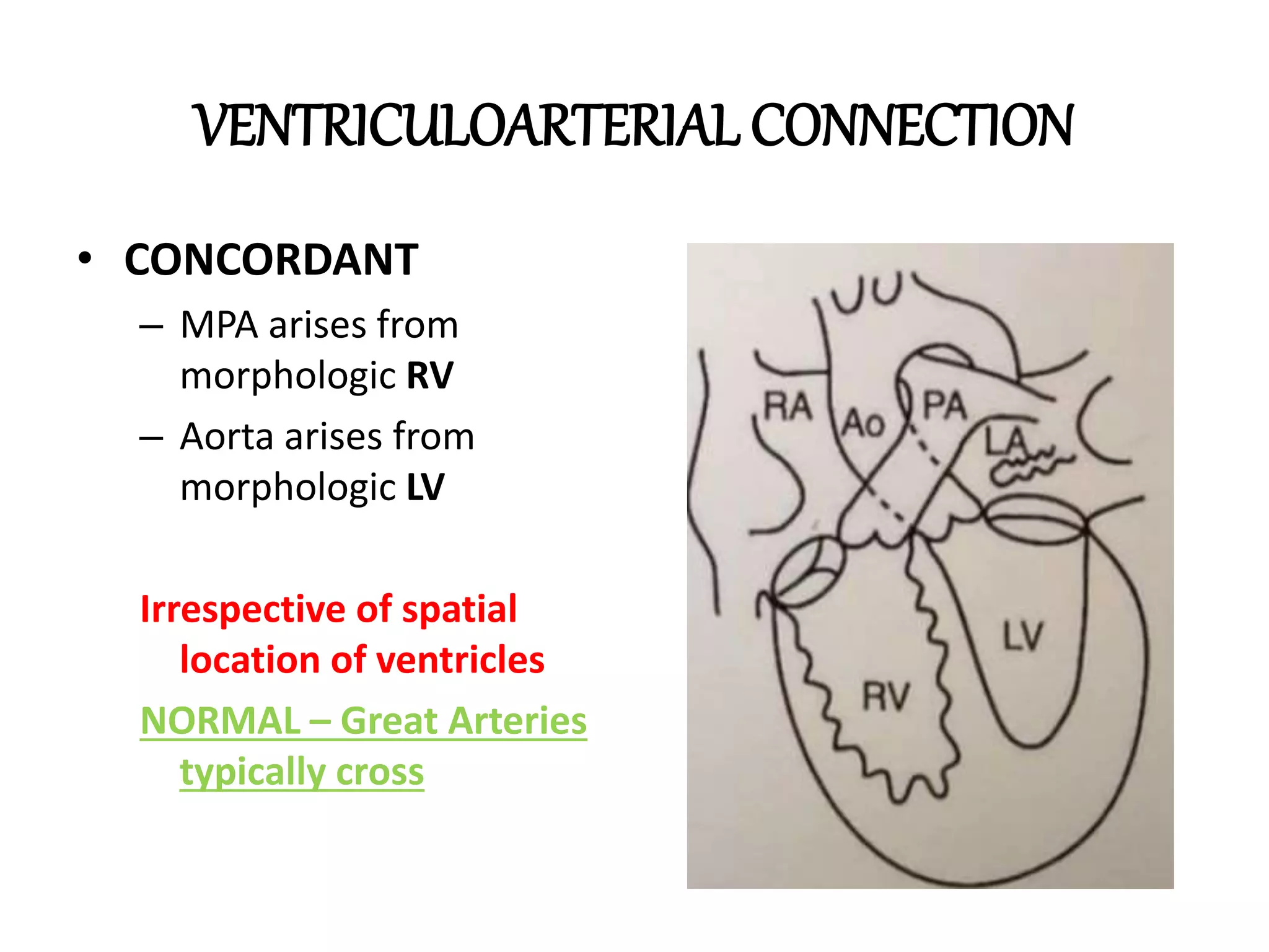 Sequential segmental analysis of heart | PPTX