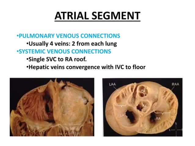 Sequential segmental analysis of heart | PPT
