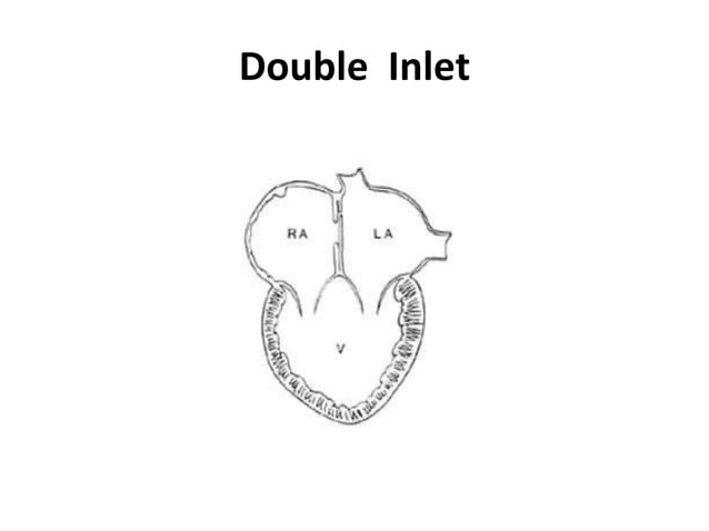 Sequential segmental analysis of heart | PPT