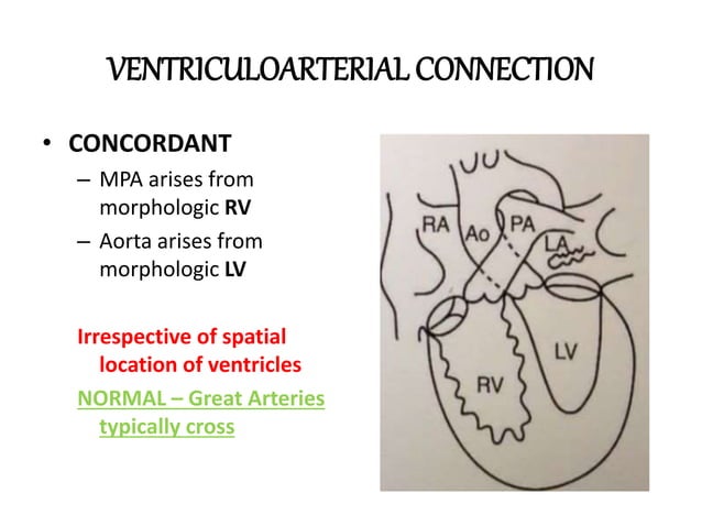 Sequential segmental analysis of heart | PPT