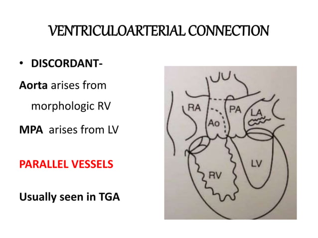 Sequential segmental analysis of heart | PPT