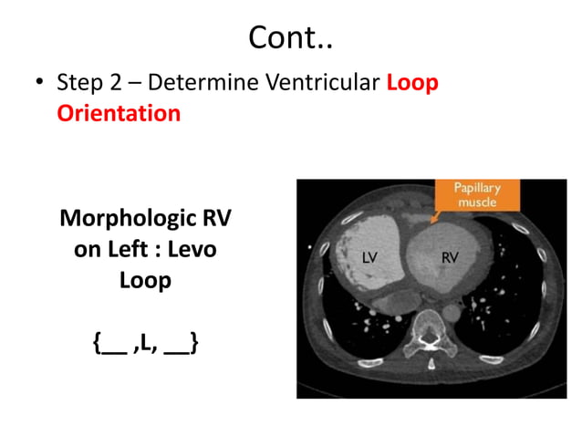 Sequential segmental analysis of heart | PPT