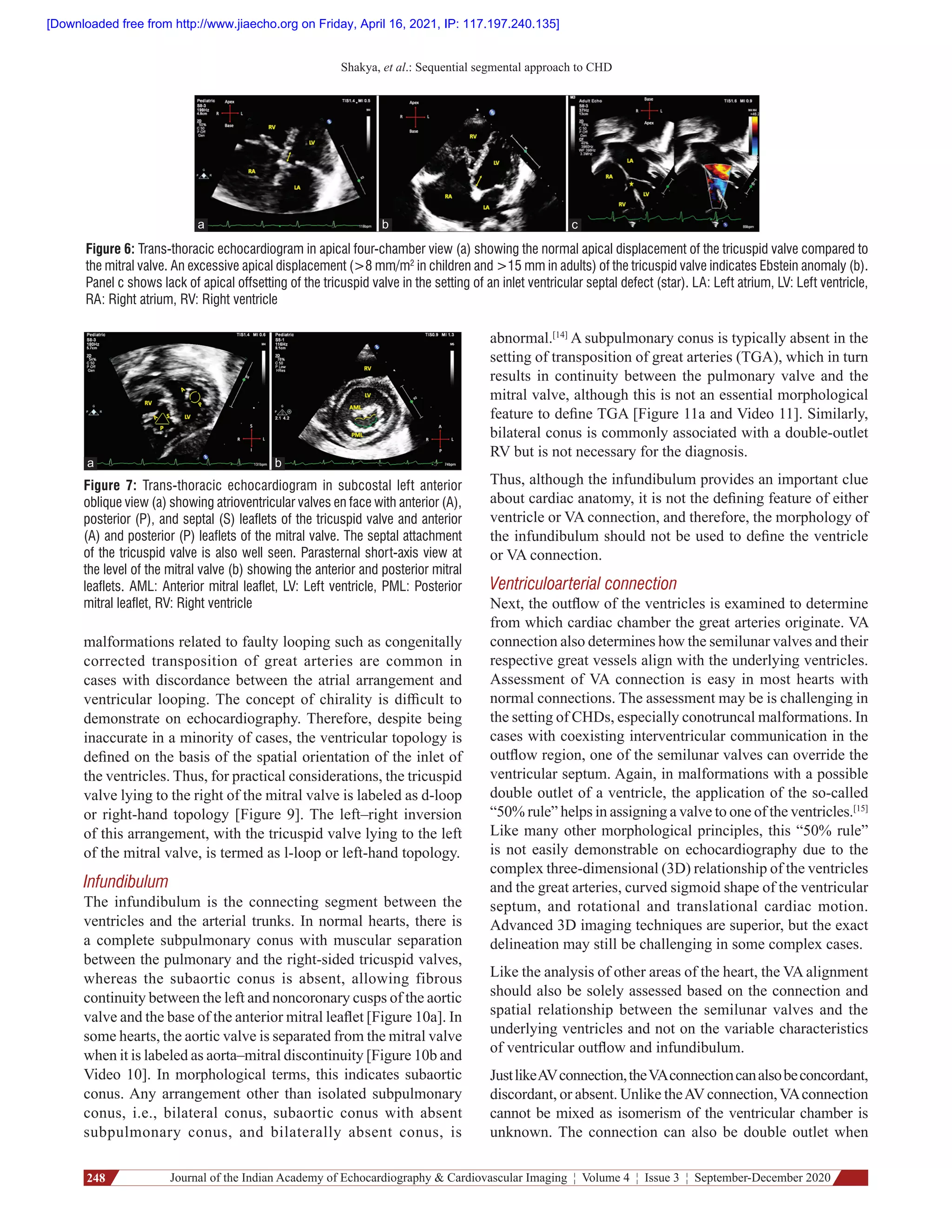 Sequential segmental approach to congenital heart disease | PDF