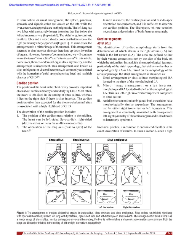 Sequential segmental approach to congenital heart disease | PDF