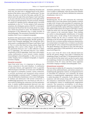 Sequential segmental approach to congenital heart disease | PDF